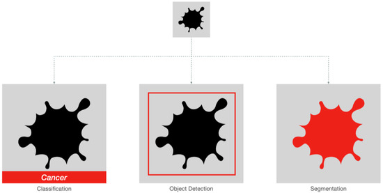 Deep Learning in Breast Cancer Imaging: State of the Art and Recent ...