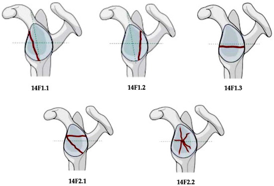 Diagnostics Free Full Text The Role Of Arthroscopy In Contemporary