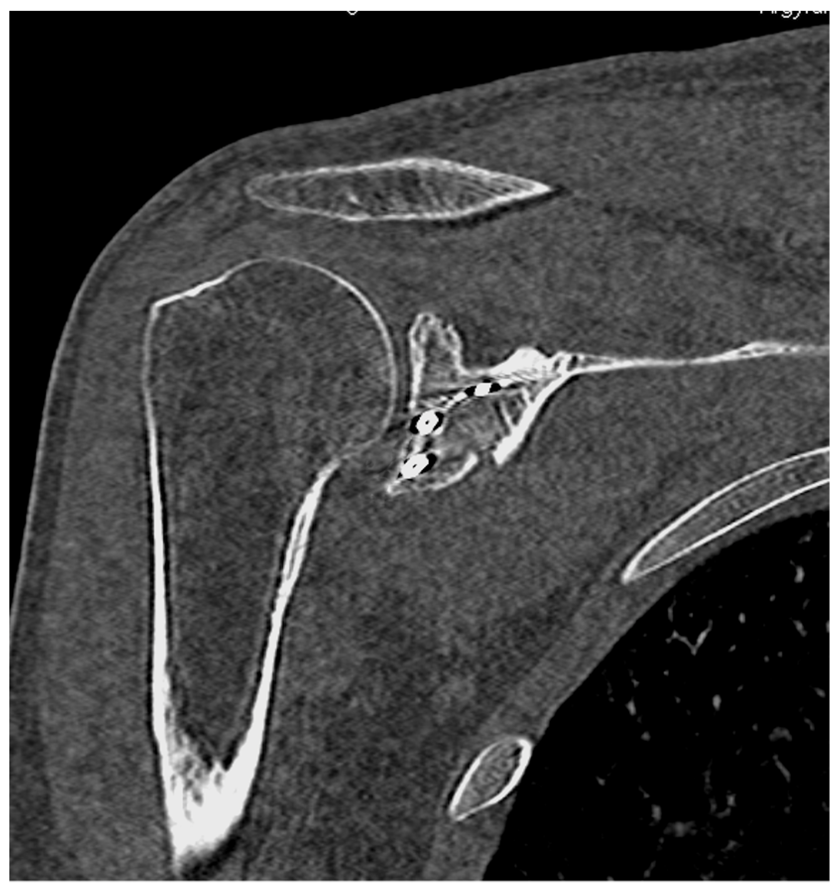 Diagnostics Free Full Text The Role Of Arthroscopy In Contemporary