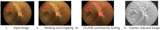 A Multi-Stage Approach for Cardiovascular Risk Assessment from Retinal ...