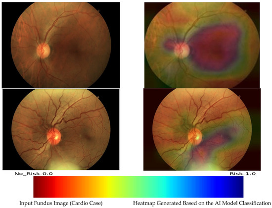 A Multi-Stage Approach for Cardiovascular Risk Assessment from Retinal ...