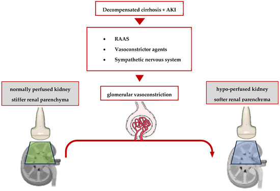 Seeing and Sensing the Hepatorenal Syndrome (HRS): The Growing Role of ...