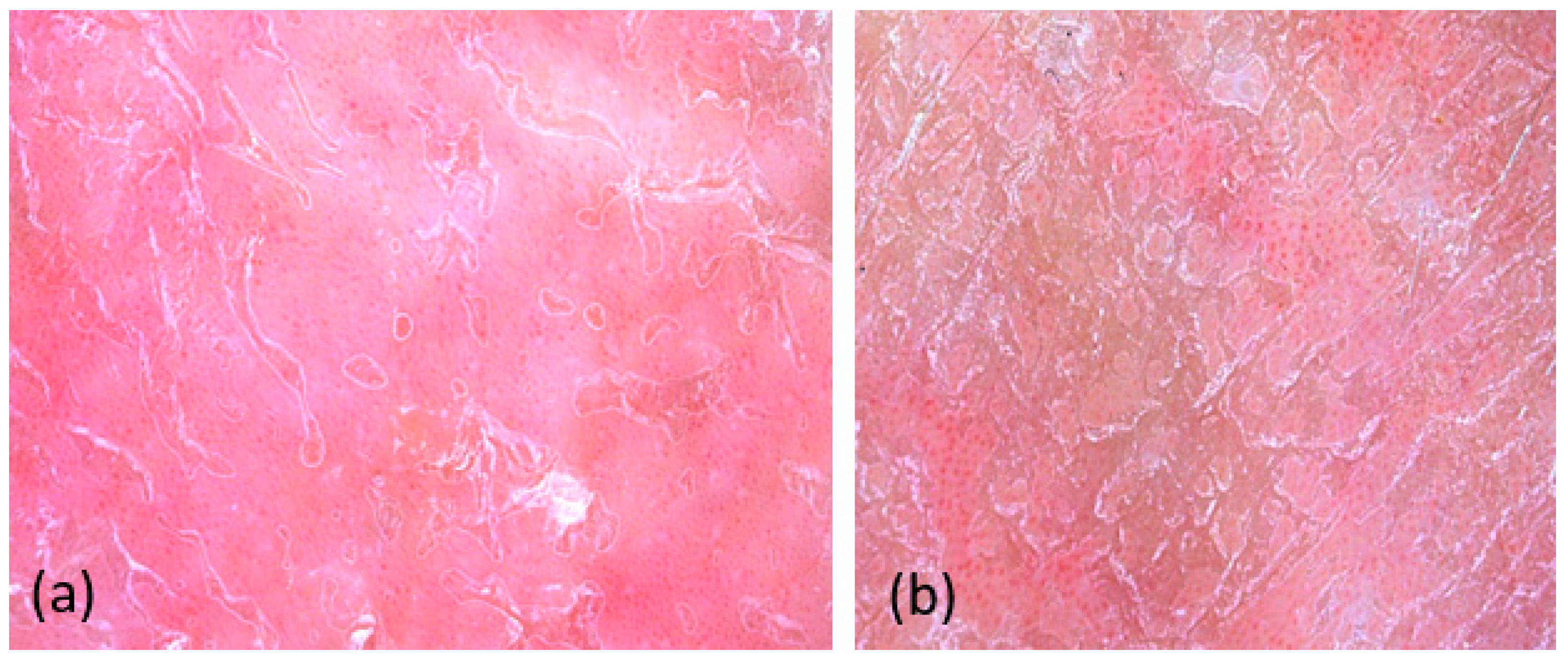 Imaging Approach in the Diagnostics and Evaluation of the Psoriasis ...