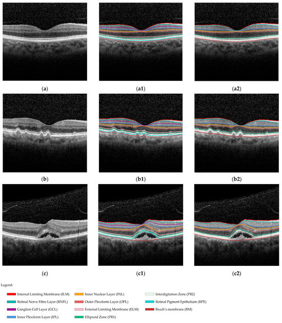 Human versus Artificial Intelligence: Validation of a Deep Learning ...