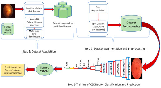 CSDNet: A Novel Deep Learning Framework for Improved Cataract State ...