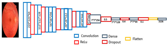 CSDNet: A Novel Deep Learning Framework for Improved Cataract State ...