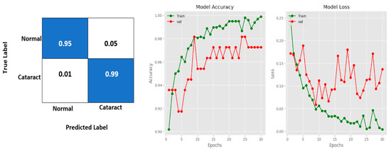 CSDNet: A Novel Deep Learning Framework for Improved Cataract State ...
