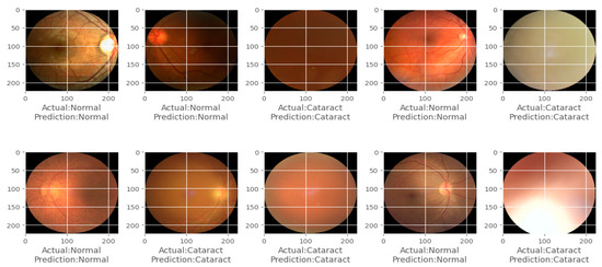 CSDNet: A Novel Deep Learning Framework for Improved Cataract State ...