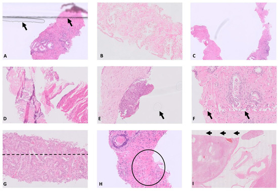 Artificial Intelligence-Based Quality Assessment of Histopathology ...