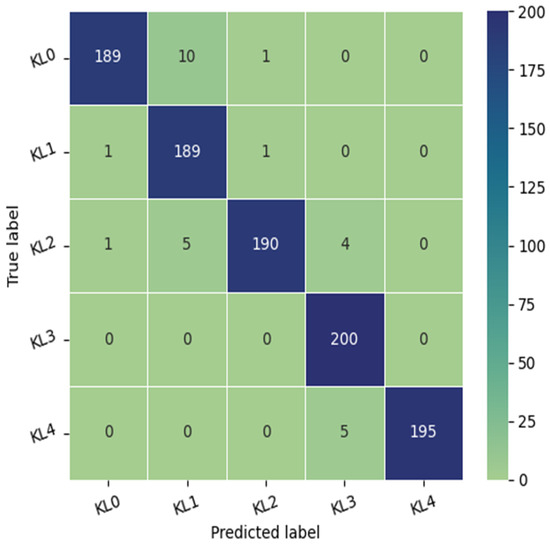 Diagnostics | Free Full-Text | MedKnee: A New Deep Learning-Based Software for Automated ...