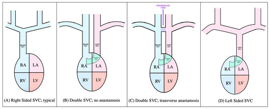 Malposition of Central Venous Catheter into Coronary Sinus throughout ...