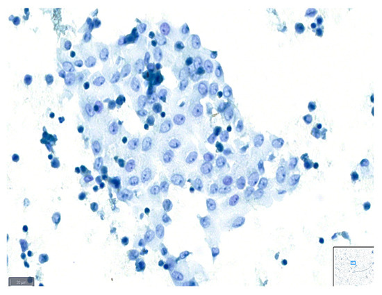 Evaluating Diagnostic Clarity: The Comparative Efficacy of BlueStain in ...