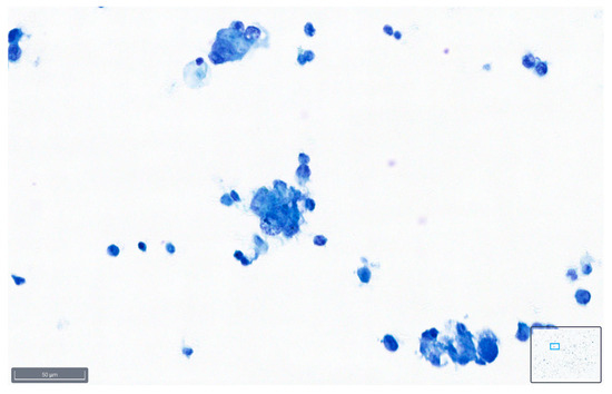 Evaluating Diagnostic Clarity: The Comparative Efficacy of BlueStain in ...