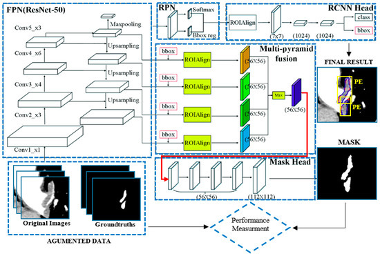 An Enhanced Mask R-CNN Approach for Pulmonary Embolism Detection and ...