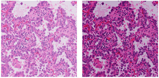 Diagnostics | Free Full-Text | Evaluating Cellularity Estimation Methods: Comparing AI Counting ...