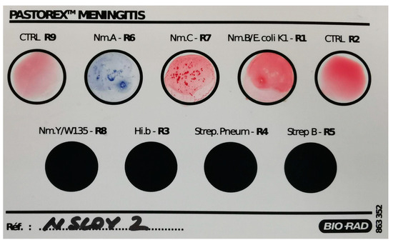 Developing a Novel Murine Meningococcal Meningitis Model Using a ...