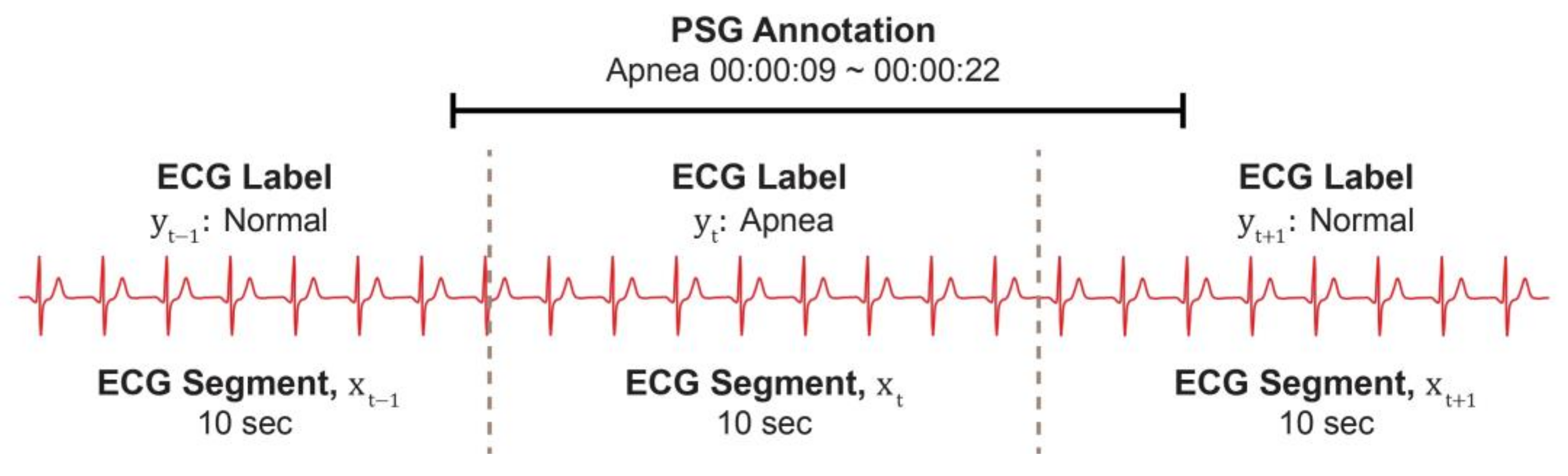 A Comprehensive Study on a Deep-Learning-Based Electrocardiography ...