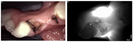 Atlas of Dental Near-Infrared Transillumination Images