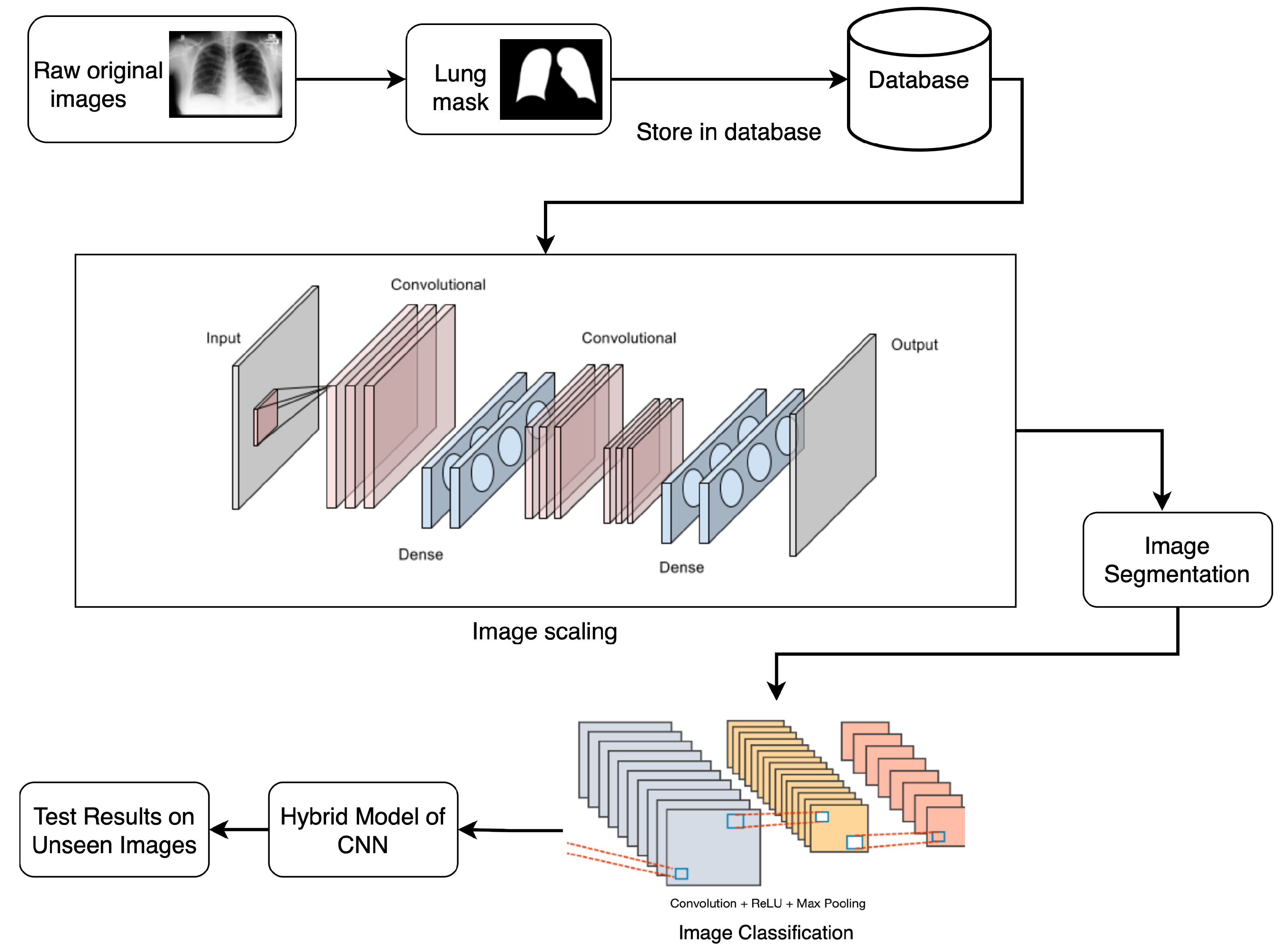 TSSG-CNN: A Tuberculosis Semantic Segmentation-Guided Model for Detecting and Diagnosis Using ...