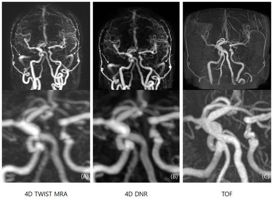 Deep Learning-Based High-Resolution Magnetic Resonance Angiography (MRA ...