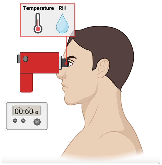 A Novel Noninvasive Screening Tool for Dry Eye Disease