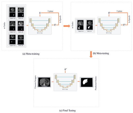 Few-Shot Learning for Medical Image Segmentation Using 3D U-Net and ...