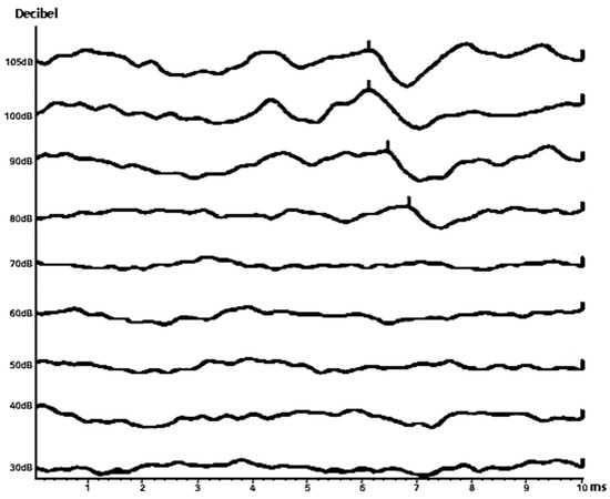 Performance Comparison of Convolutional Neural Network-Based Hearing ...