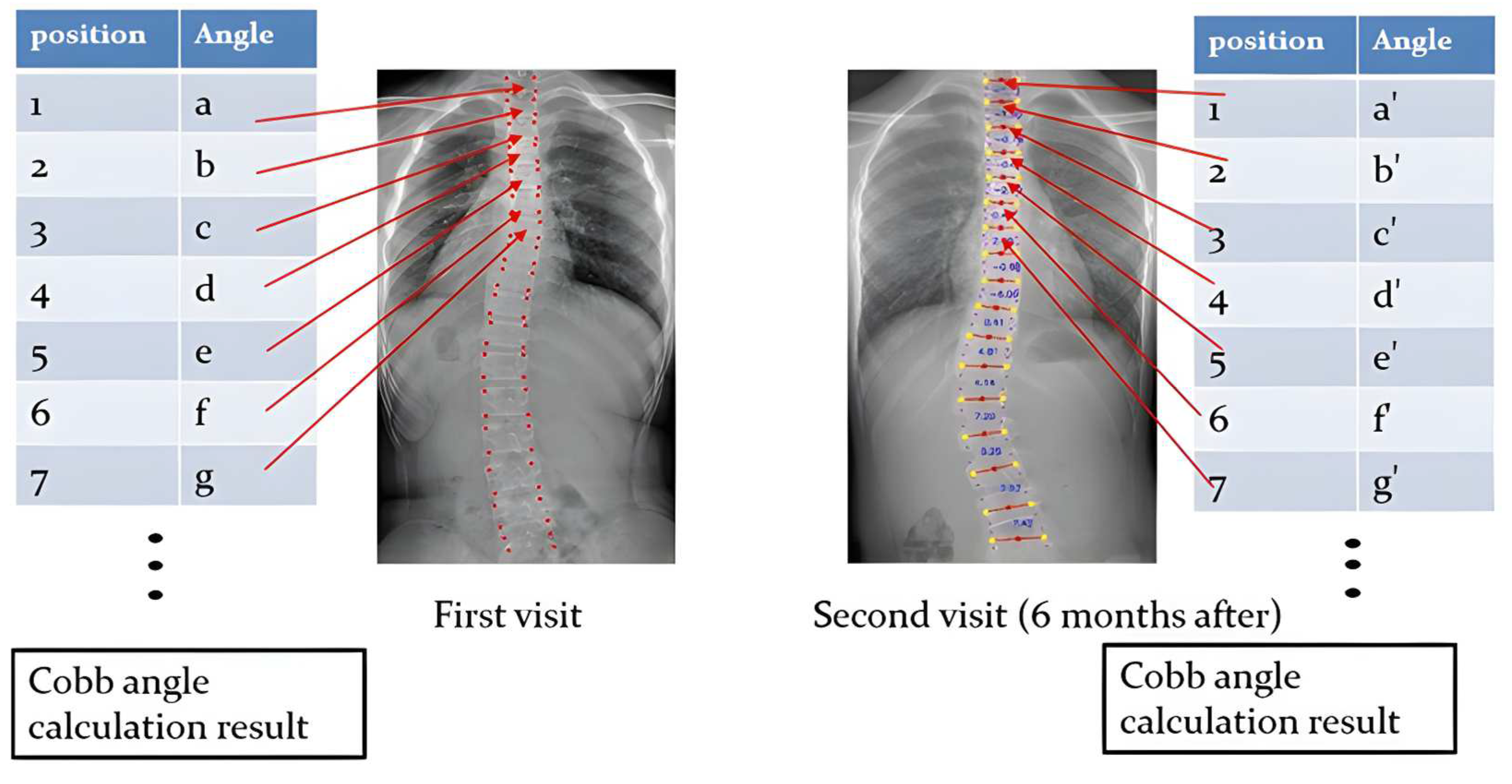 Deep Learning-Based Prediction Model for the Cobb Angle in Adolescent Idiopathic Scoliosis Patients