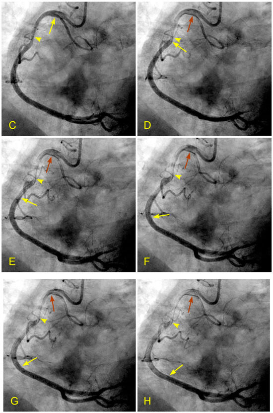 Introducing a Novel Innovative Technique for the Recording and ...