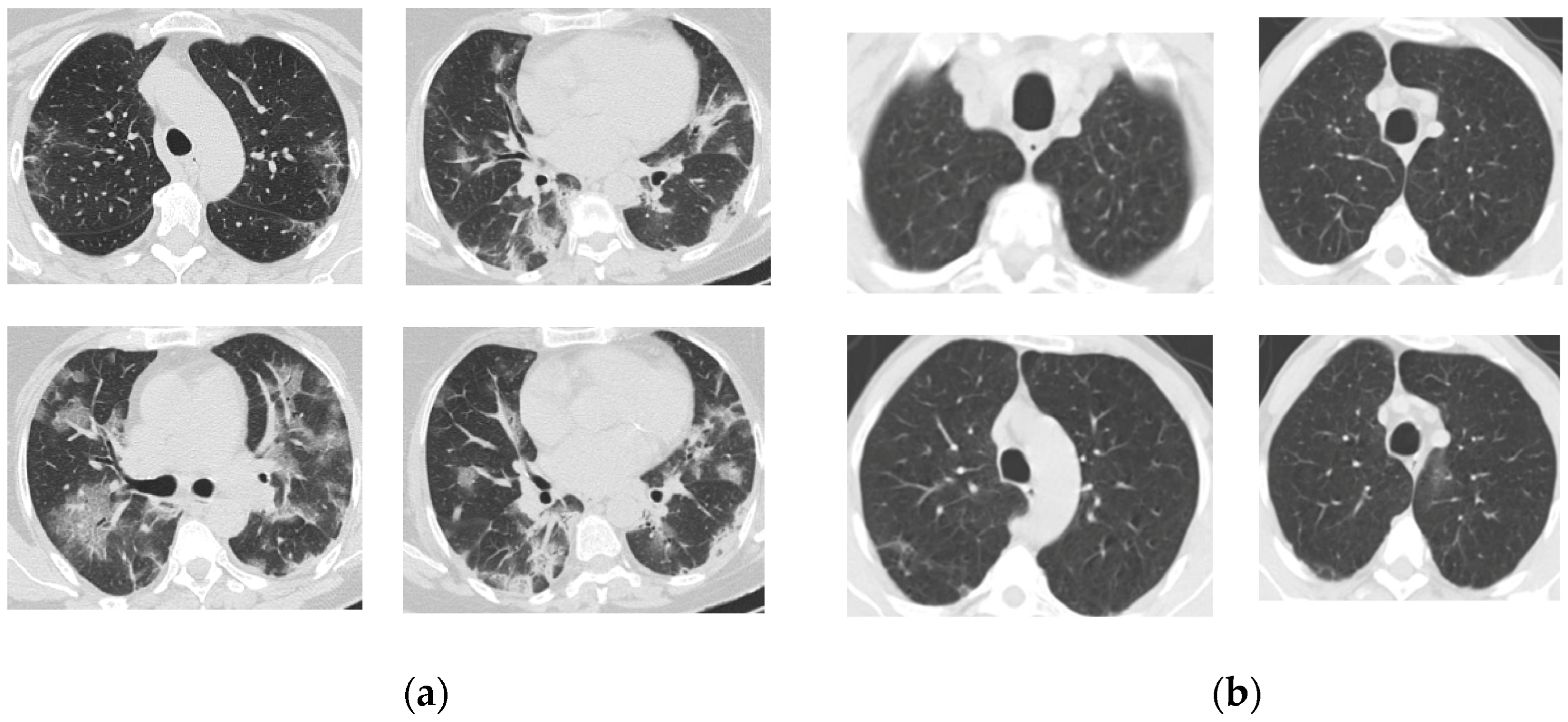 Diagnostics | Free Full-Text | Lung Disease Detection Using U-Net ...