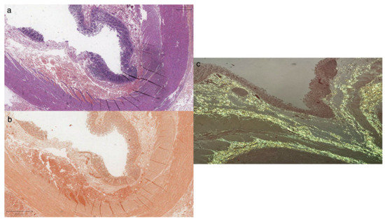The Multifaceted Complexity of Tumor Necrosis Factor Receptor ...