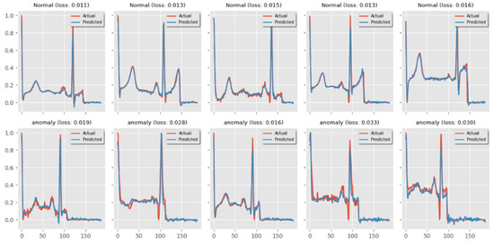 AI-Driven Real-Time Classification of ECG Signals for Cardiac Monitoring Using i-AlexNet ...
