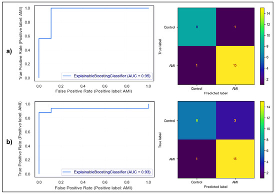 Combining the Strengths of the Explainable Boosting Machine and Metabolomics Approaches for ...