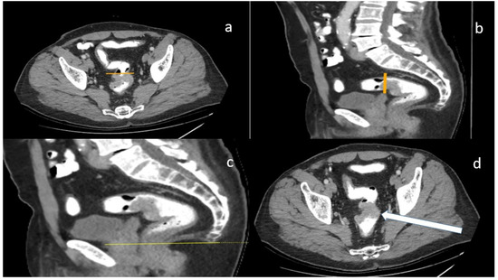 Diagnostic Benefits and Surgical Implications of Methods for Tumor ...
