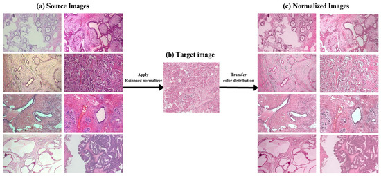 Attention-Based Deep Learning Approach for Breast Cancer ...
