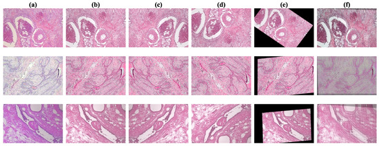 Attention-Based Deep Learning Approach for Breast Cancer ...