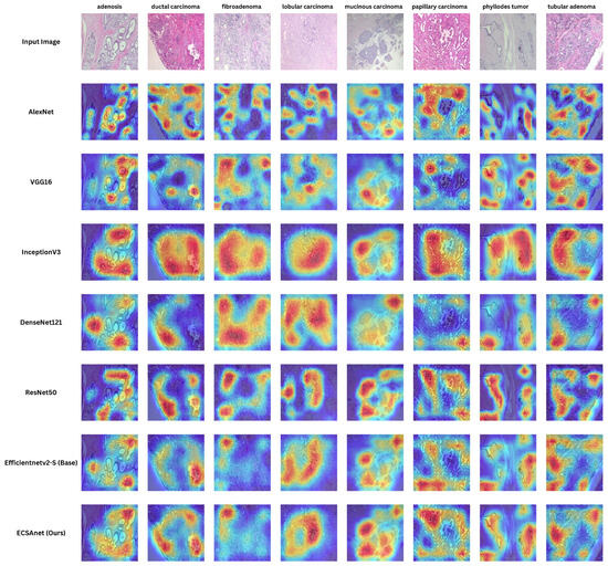 Attention-Based Deep Learning Approach for Breast Cancer ...
