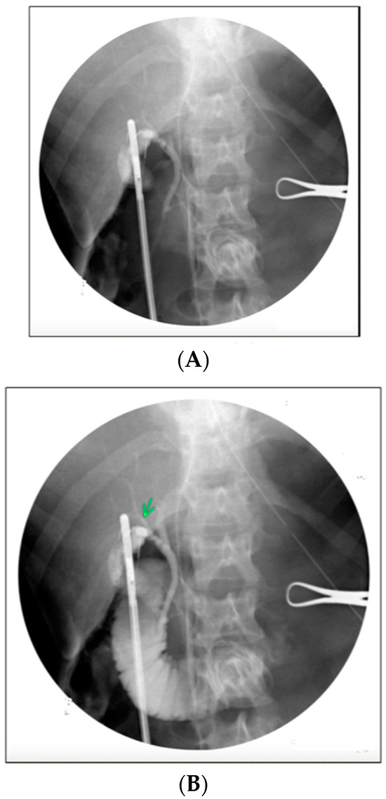 The Impact of Intraoperative Glucagon on the Diagnostic Accuracy of ...