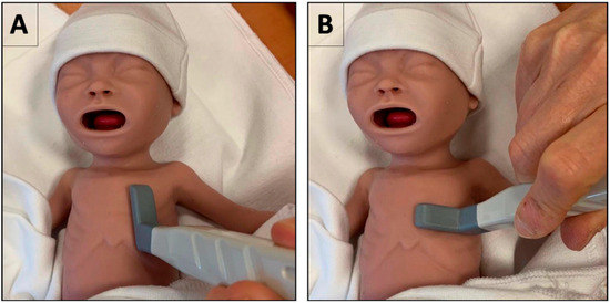 Setting the Standards: Neonatal Lung Ultrasound in Clinical Practice