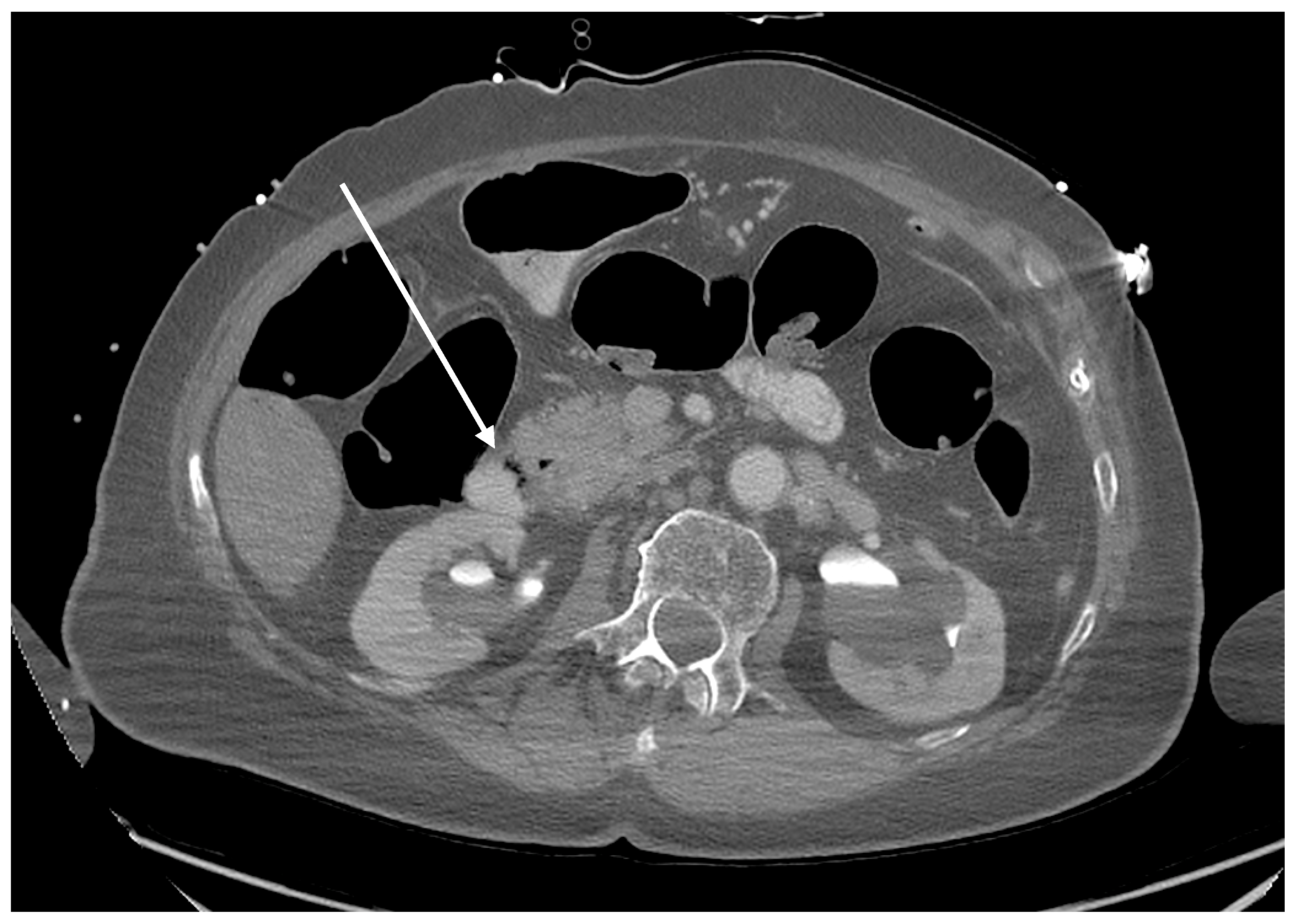 Diagnostics | Free Full-Text | Analysis of Tomographic Images of a ...