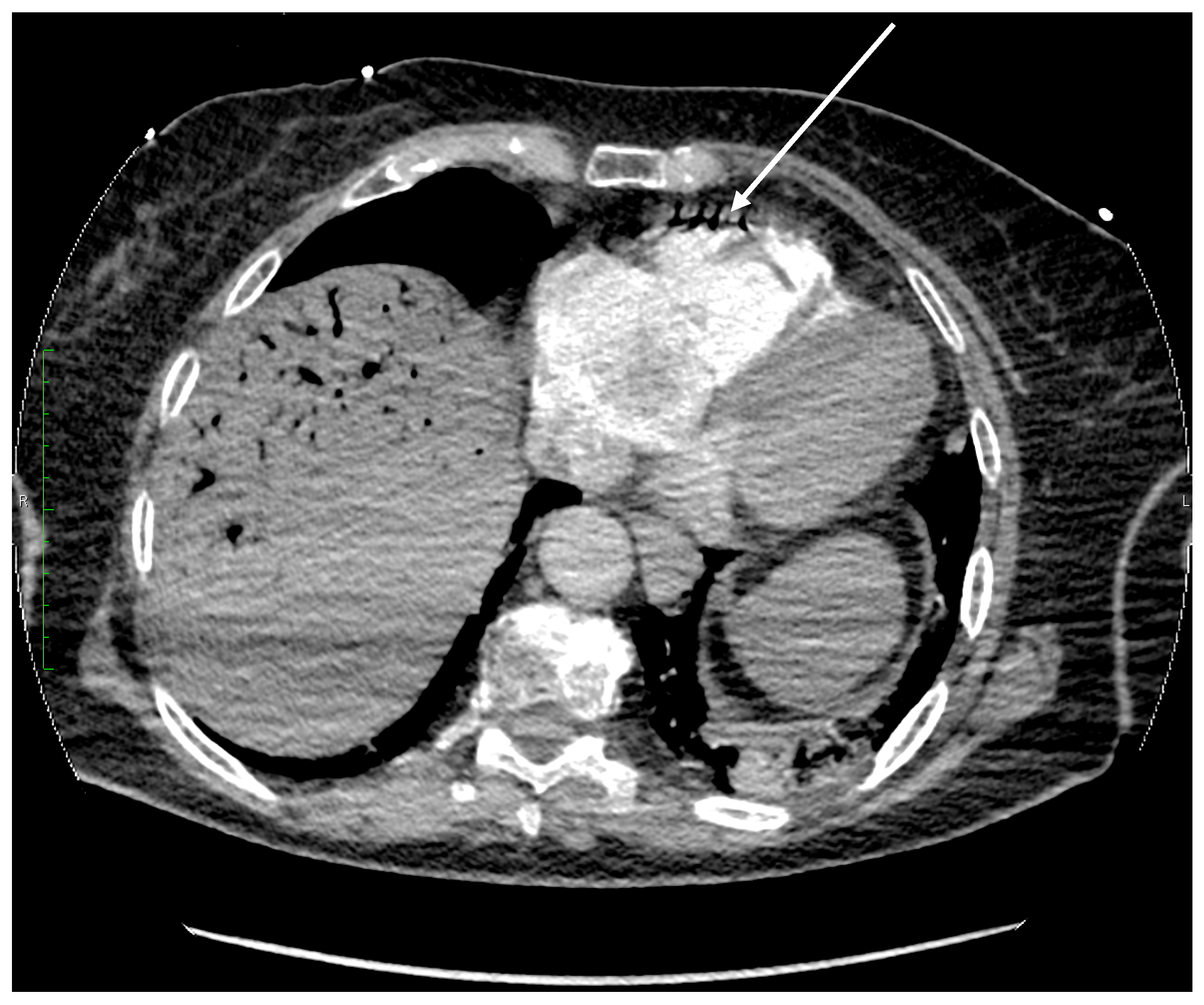 Diagnostics | Free Full-Text | Analysis of Tomographic Images of a ...