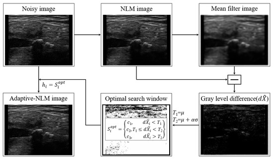 Performance Evaluation of Ultrasound Images Using Non-Local Means Algorithm with Adaptive ...