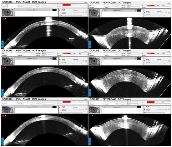 Combined Rotating Ultra-High-Resolution Spectral Domain OCT and ...