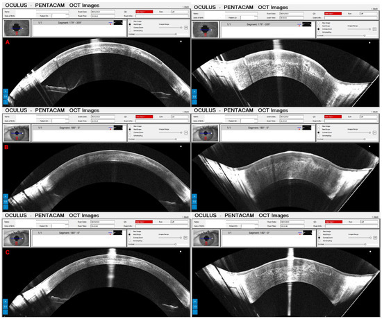 Combined Rotating Ultra-High-Resolution Spectral Domain OCT and ...