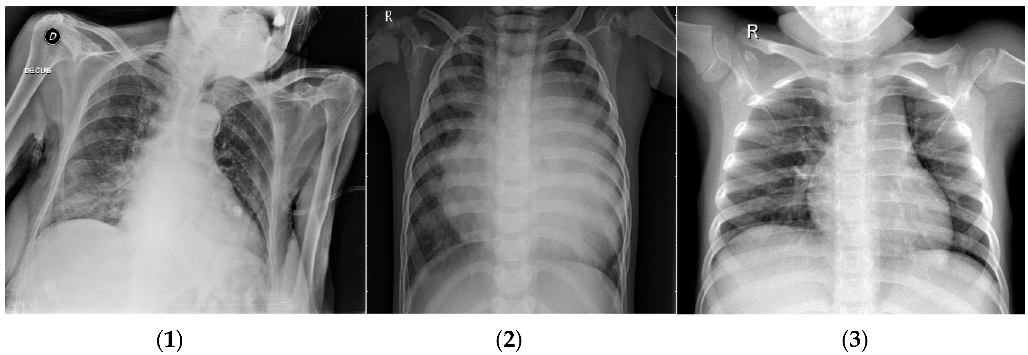 Diagnostics | Free Full-Text | A Novel Hybrid Machine Learning-Based ...