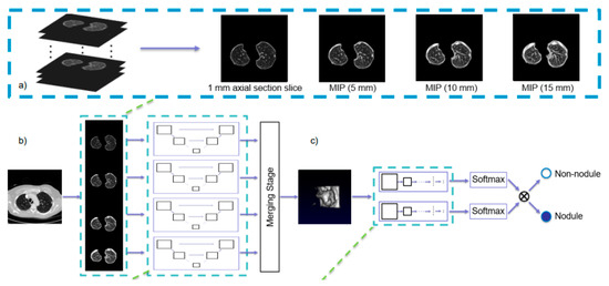 Research on Artificial-Intelligence-Assisted Medicine: A Survey on ...