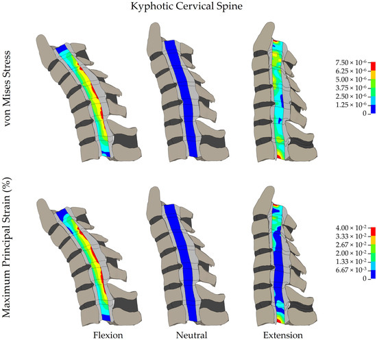 Using Finite Element Models to Assess Spinal Cord Biomechanics after ...