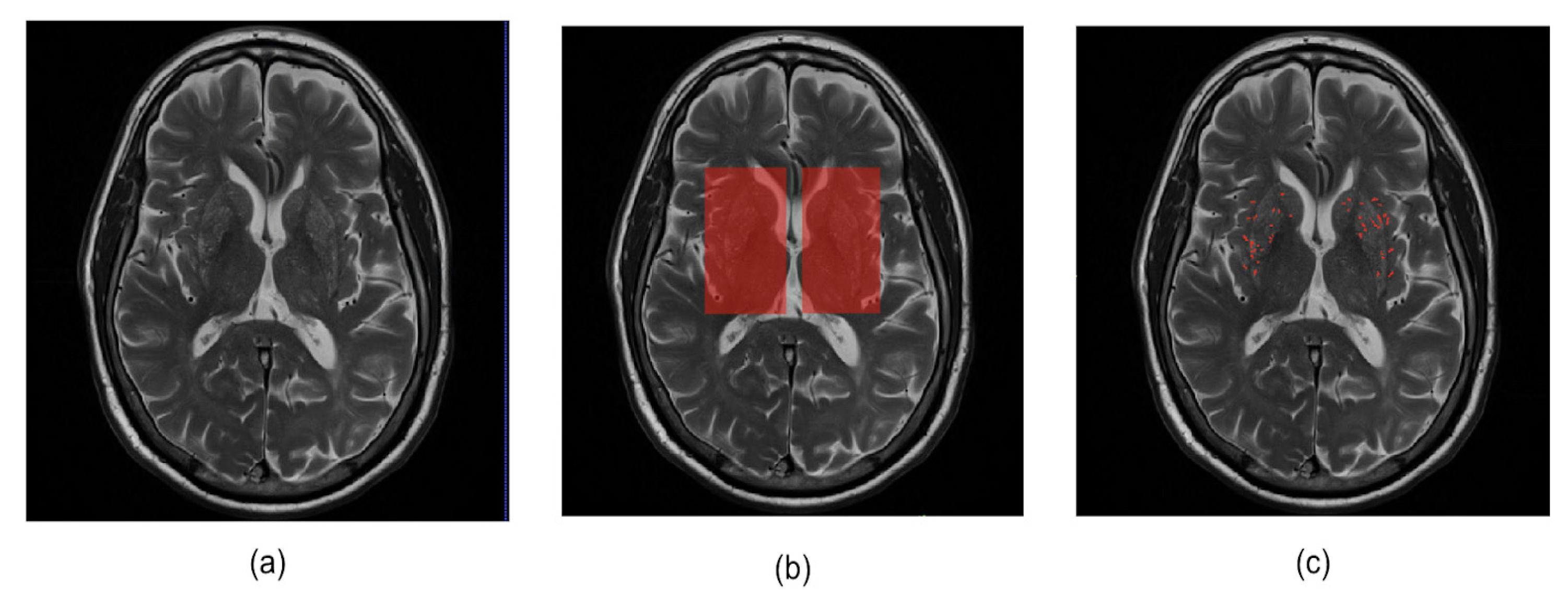 Deep Cascade of Convolutional Neural Networks for Quantification of ...