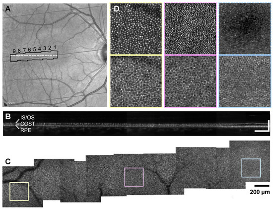 Quantification of Human Photoreceptor–Retinal Pigment Epithelium ...