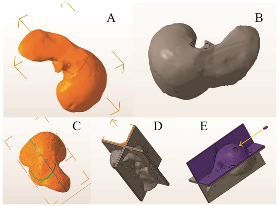 Liver Phantoms Cast in 3D-Printed Mold for Image-Guided Procedures